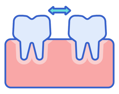 Diastema: Discover the Types of Gap Teeth & How to Treat Them