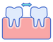 Diastema: Discover the Types of Gap Teeth & How to Treat Them